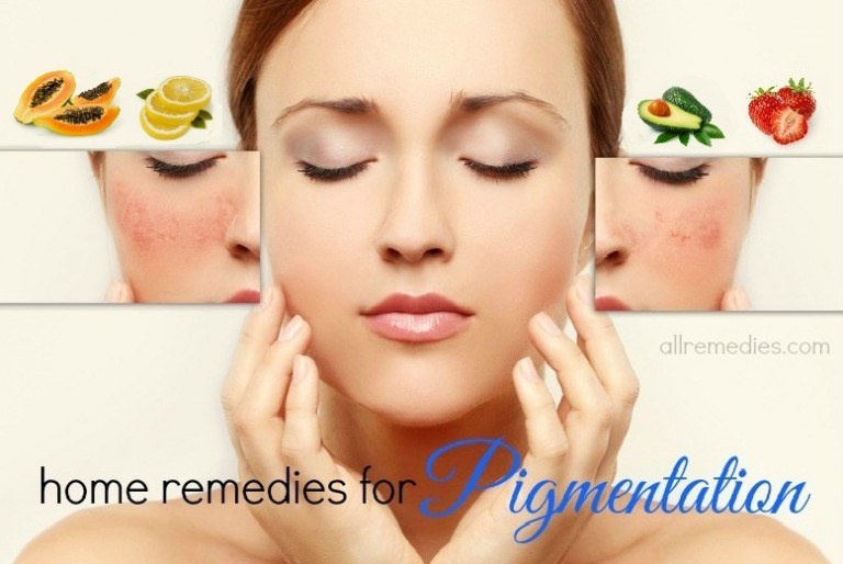 Top 13 Home Remedies for Pigmentation on Face