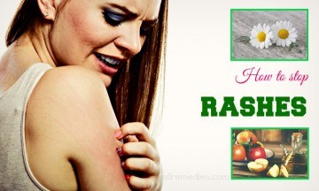 18 Tips on How to Stop Rashes From Spreading and Itching