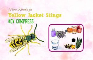 13 Best Home Remedies For Yellow Jacket Stings And Swelling
