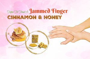 Top 11 Remedies On How To Treat A Jammed Finger Naturally