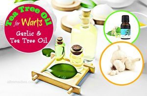 Top 14 Practical Ways How To Use Tea Tree Oil For Warts On Feet And Hands