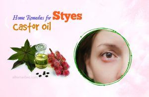 25 Evidence-Based Home Remedies For Styes Under & Upper Eyelid