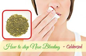 Top 14 Natural Home Remedies How To Stop Nose Bleeding Instantly