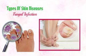 Top 7 Common Types Of Skin Diseases: Causes, Symptoms, Diagnosis