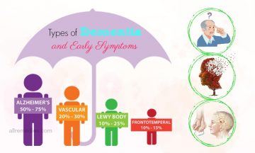 List Of 17 Common Types Of Dementia And Early Symptoms