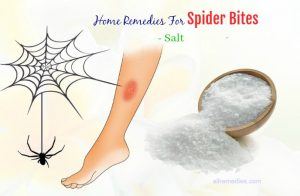 Symptoms & 24 Home Remedies For Spider Bites Itching On Face & Arm