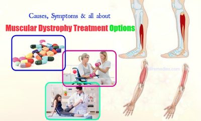 Causes, Symptoms & All About Muscular Dystrophy Treatment Options